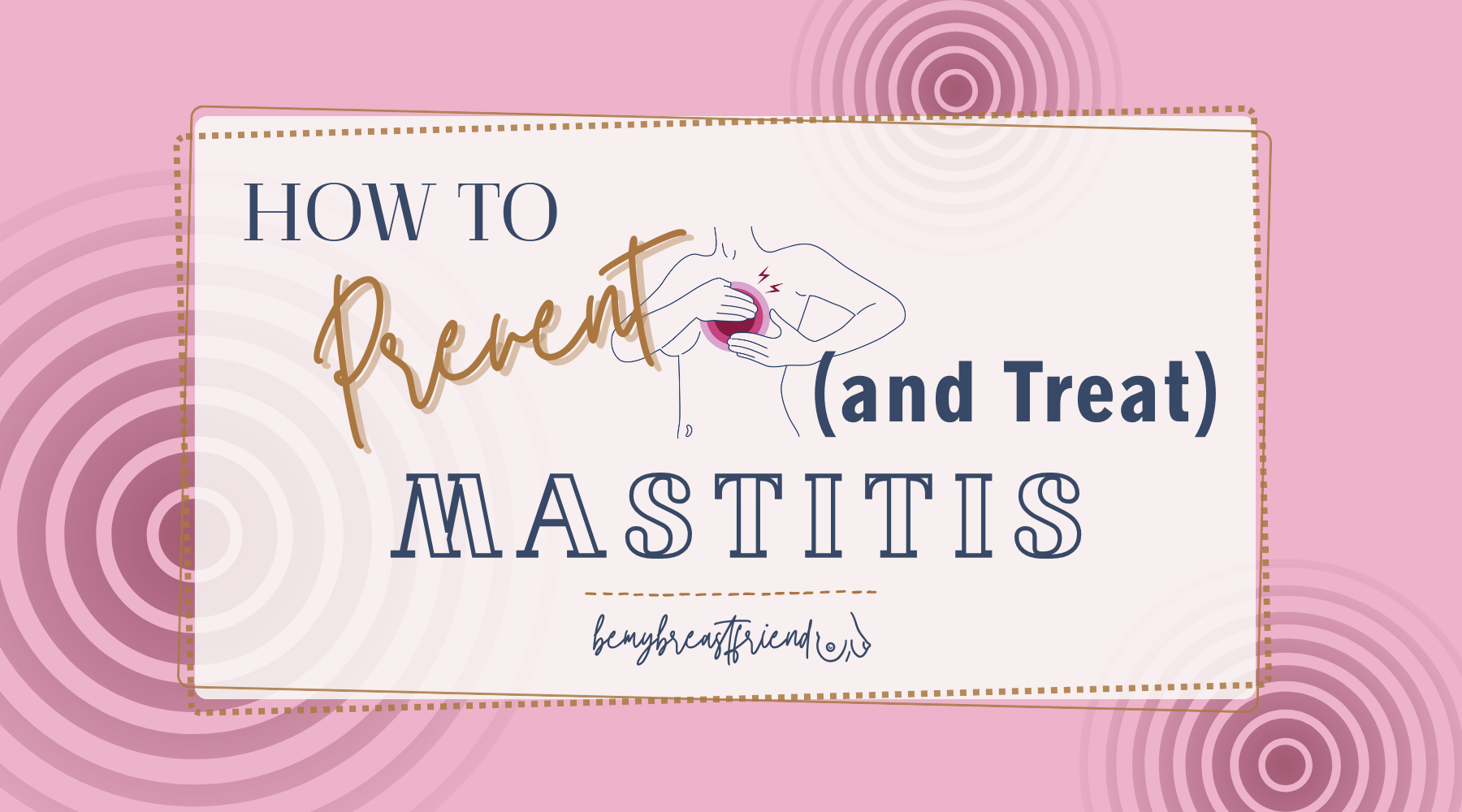 How to Prevent (and Treat) Mastitis – bemybreastfriend, LLC